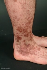 Cirurgião Vascular e Angiologista em São Paulo - Dr. Ítalo Abreu
